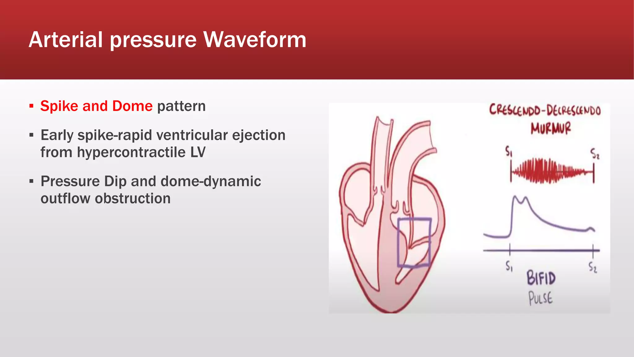 HCM Hypertrophic cardiomyopathy.pptx