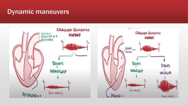 HCM Hypertrophic cardiomyopathy.pptx