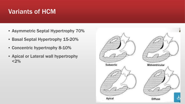 HCM Hypertrophic cardiomyopathy.pptx