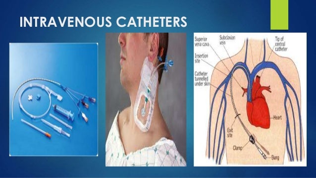 Hemodialysis and peritoneal dialysis