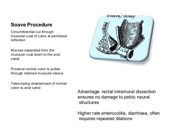 Hirchsprang's disease