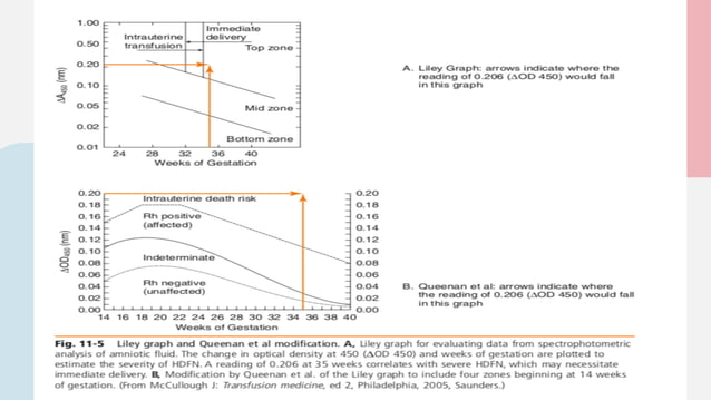 Hemolytic Disease of the Fetus and Newborn (HDFN) | PDF | Pregnancy ...