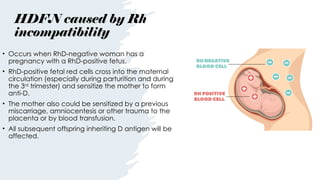 Hemolytic disease of the fetus and newborn hematology .pptx