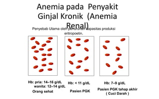 HD Khusus & Anemia tugas ckd untuk edukasi.pptx