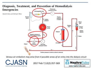 Major Acute Hemodialysis Complications - Hoping to Prevent - Dr. Gawad ...