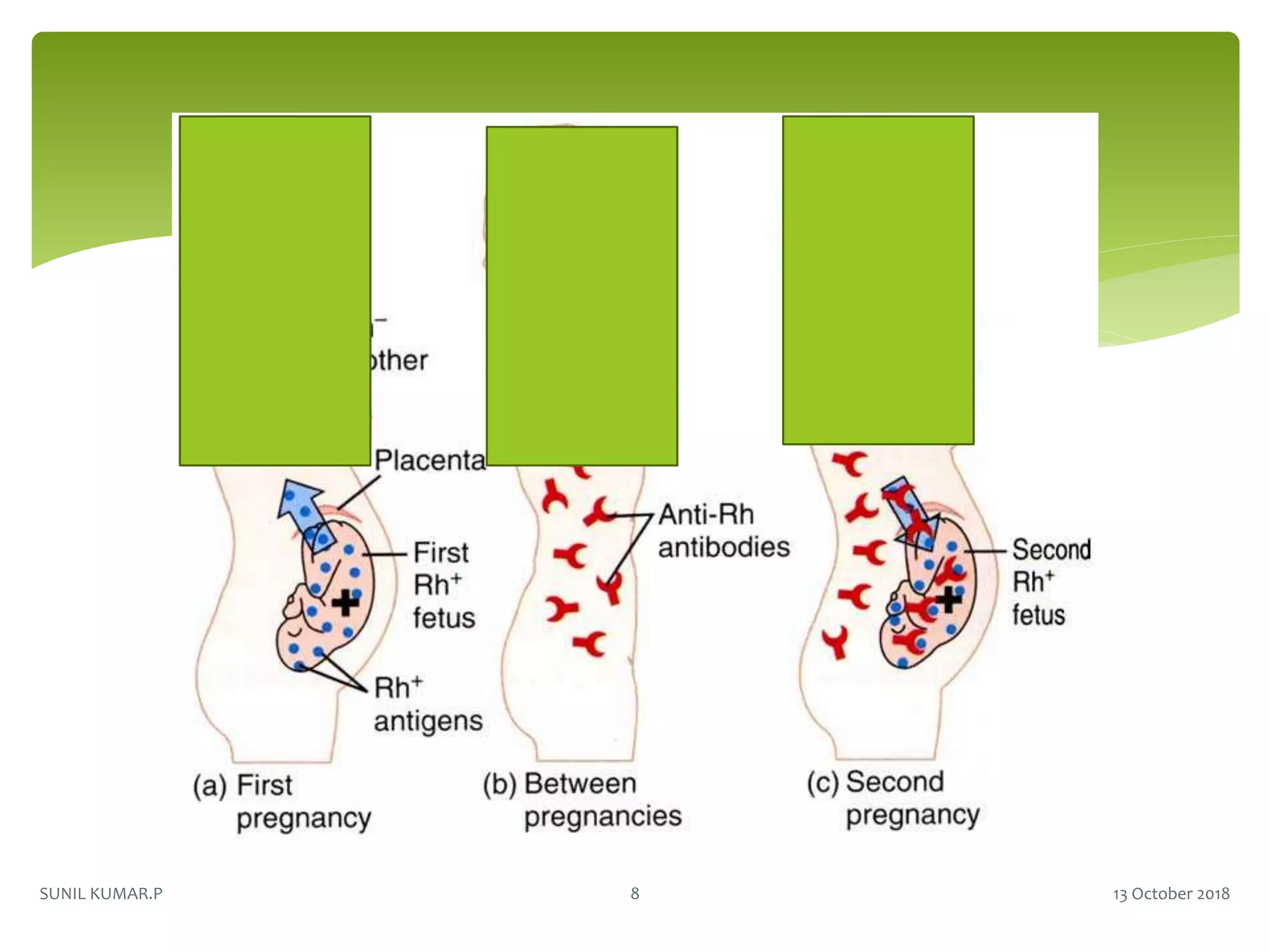 Hdn and exchange transfusion | PPTX | Pregnancy | Reproductive Health