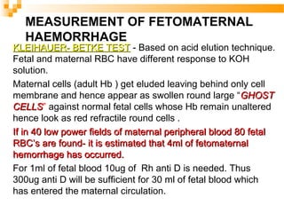 hemolytic disease of new born | PPT