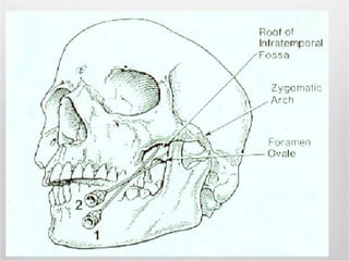 head and neck injections.ppt