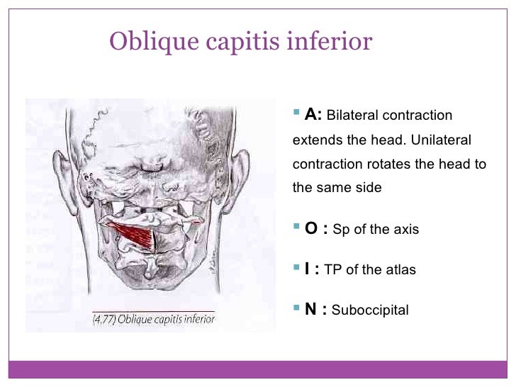 Obliquus Capitis Inferior