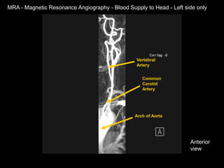 head-and-neck-radiographs.ppt for Ent residents | PPT