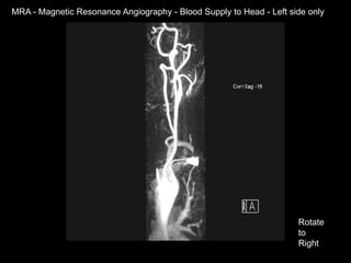 head-and-neck-radiographs.ppt for Ent residents | PPT