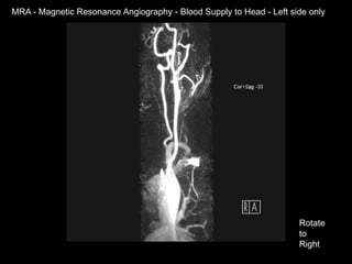 head-and-neck-radiographs.ppt for Ent residents | PPT