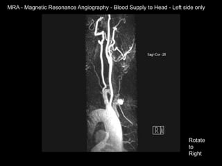 head-and-neck-radiographs.ppt for Ent residents | PPT