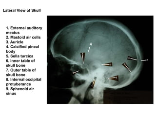 head-and-neck-radiographs.ppt for Ent residents | PPT