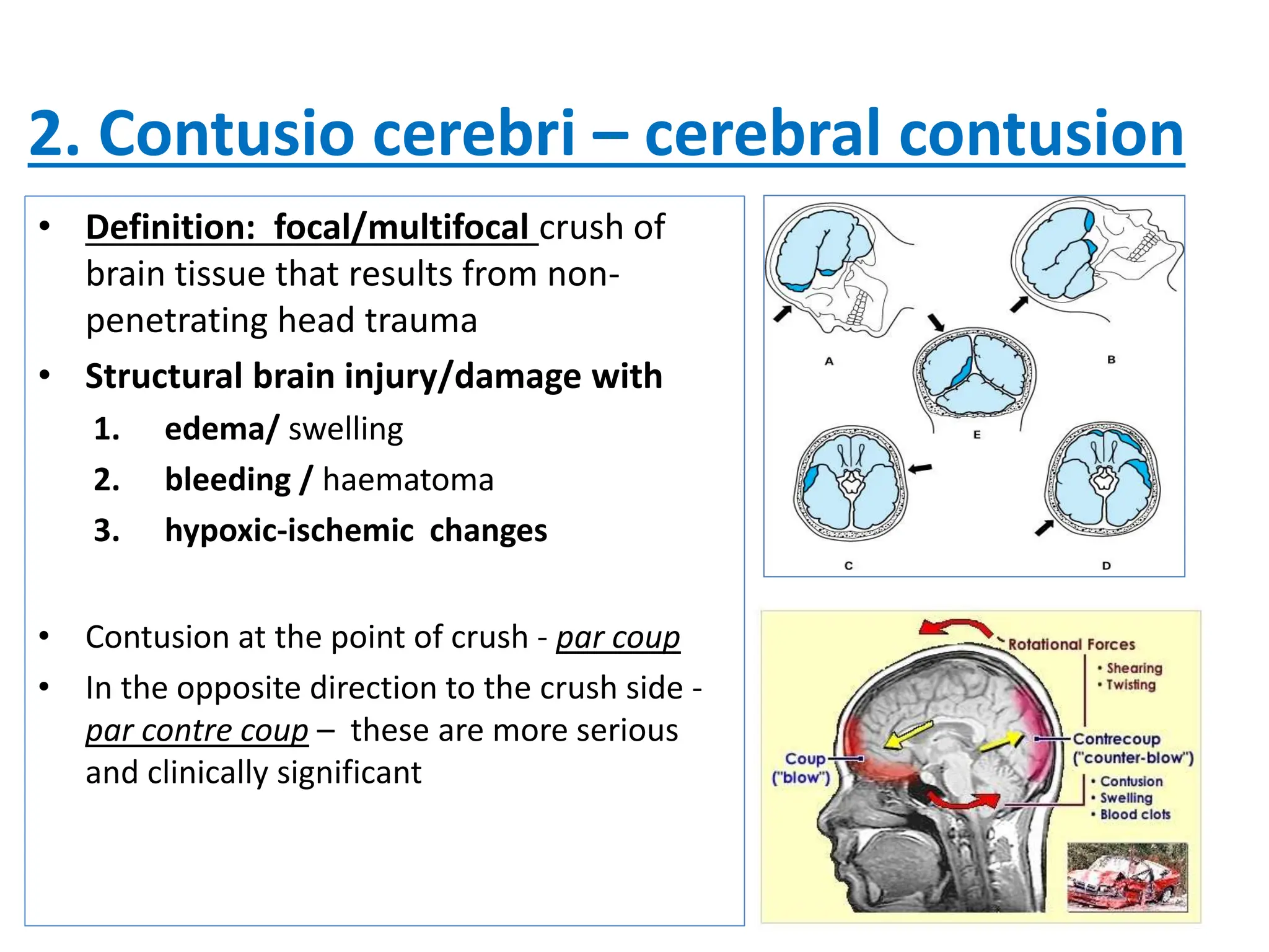 Head-and-spinal-cord-injury for nurse in emergency | PPT | Death ...