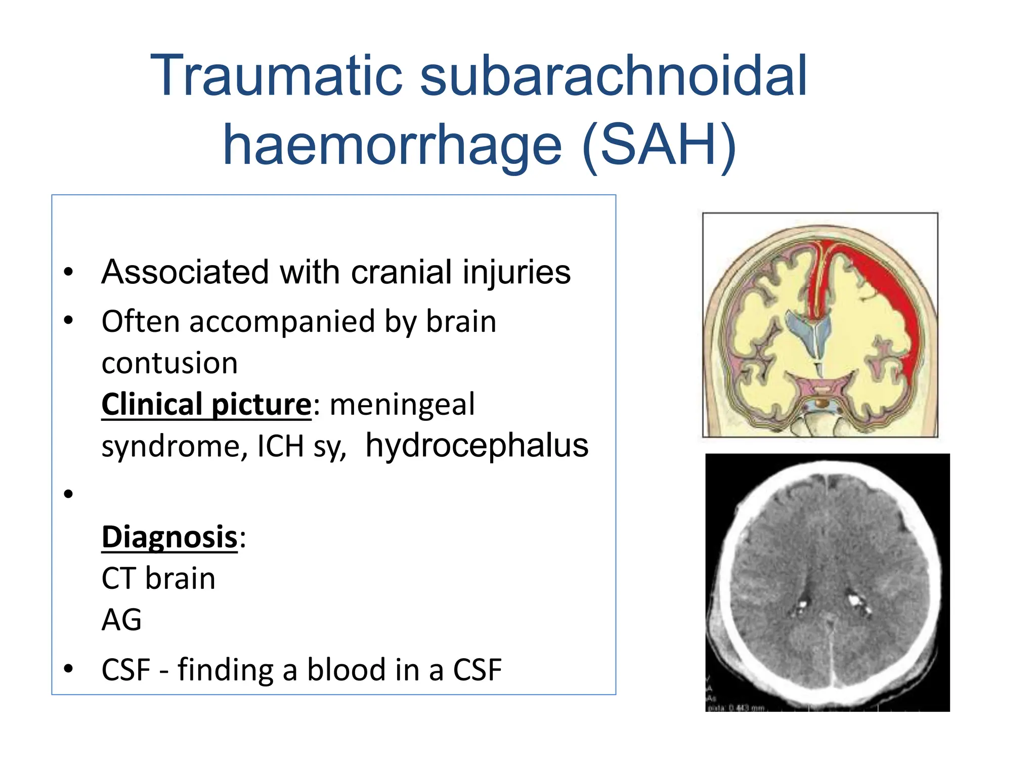 Head-and-spinal-cord-injury for nurse in emergency | PPT