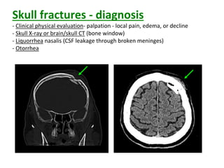 Head-and-spinal-cord-injury open and closed focal and diffuse primary ...