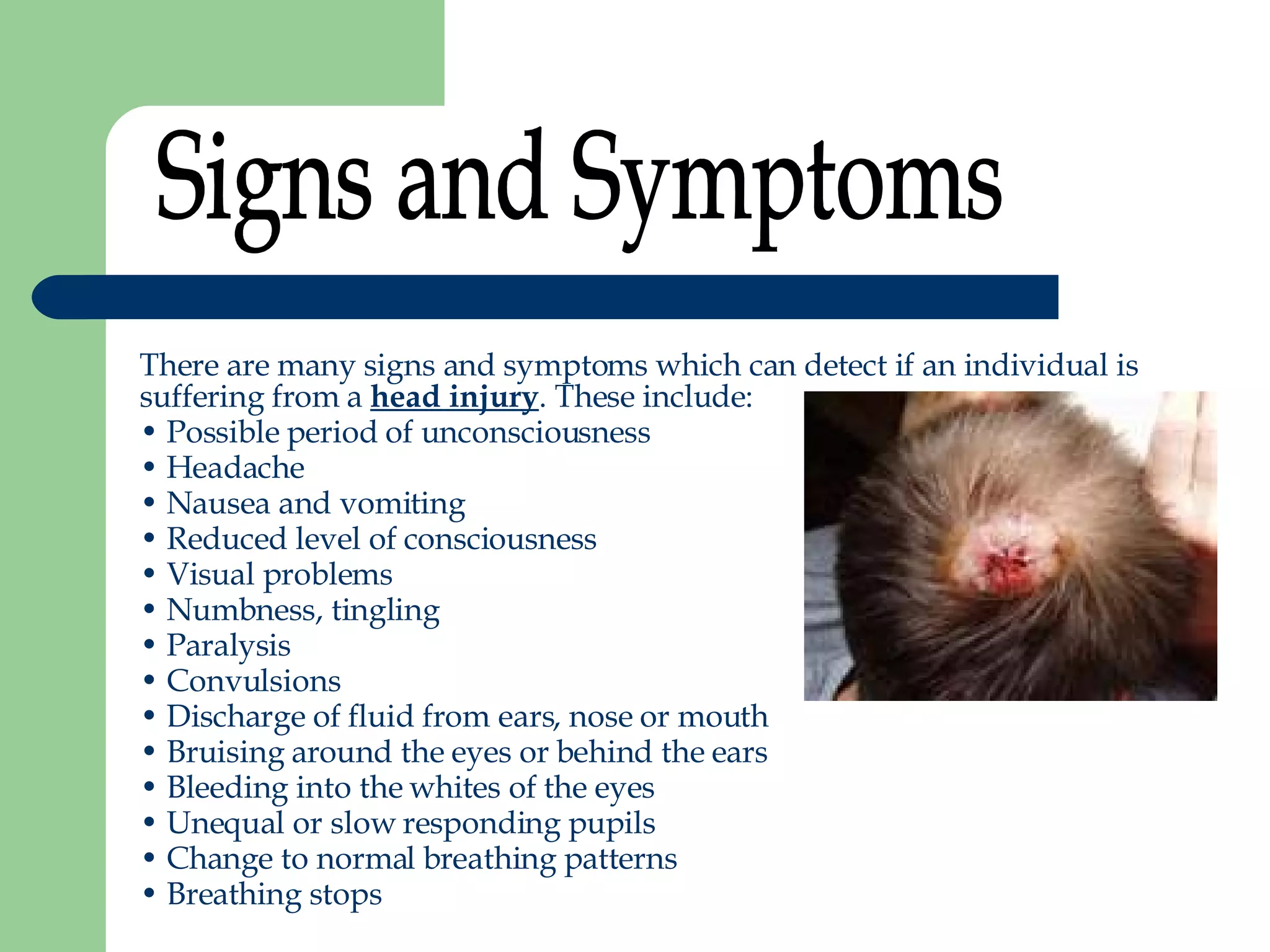 Head Injuries & Concussion | PPT