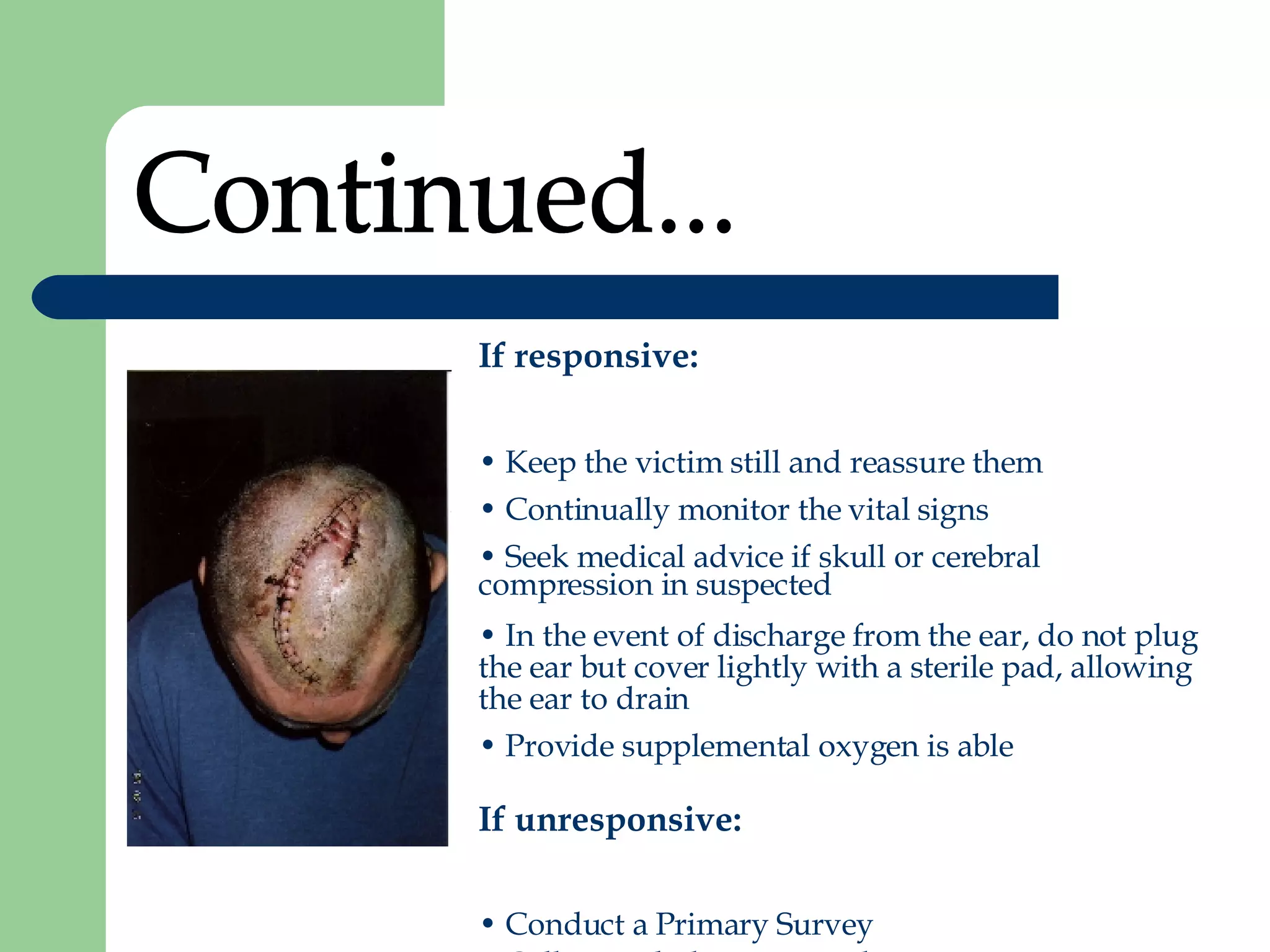 Head Injuries & Concussion | PPT