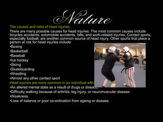 Head Injuries & Concussion | PPT