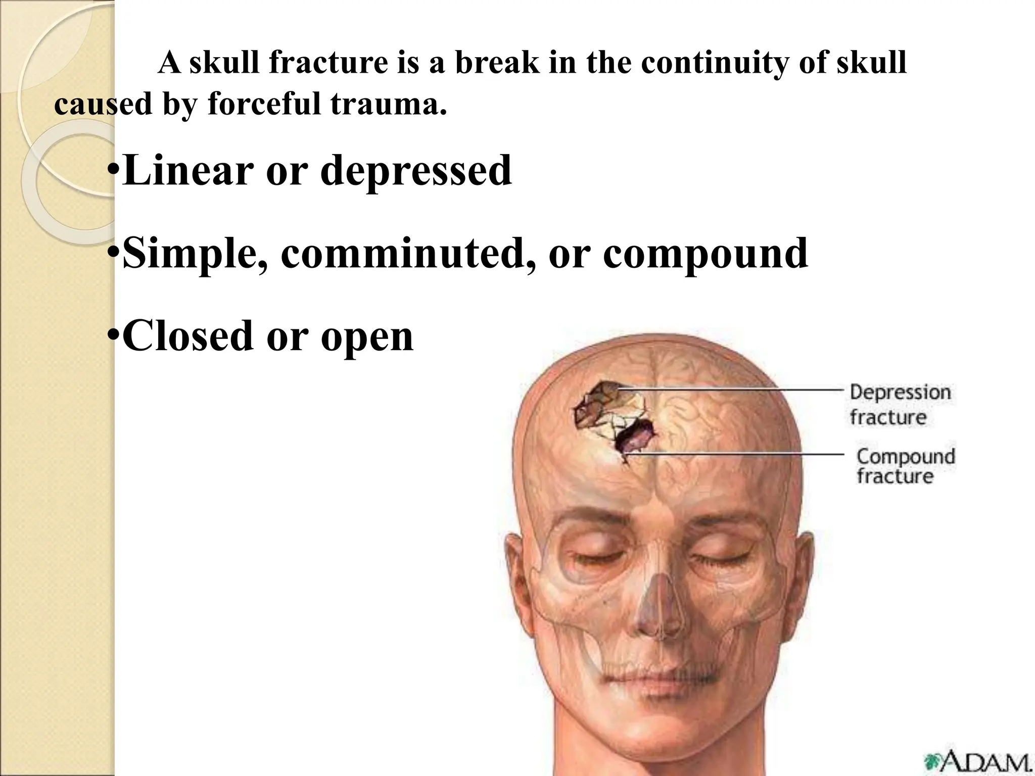 head-injury head injury HEAD INJURY .ppt