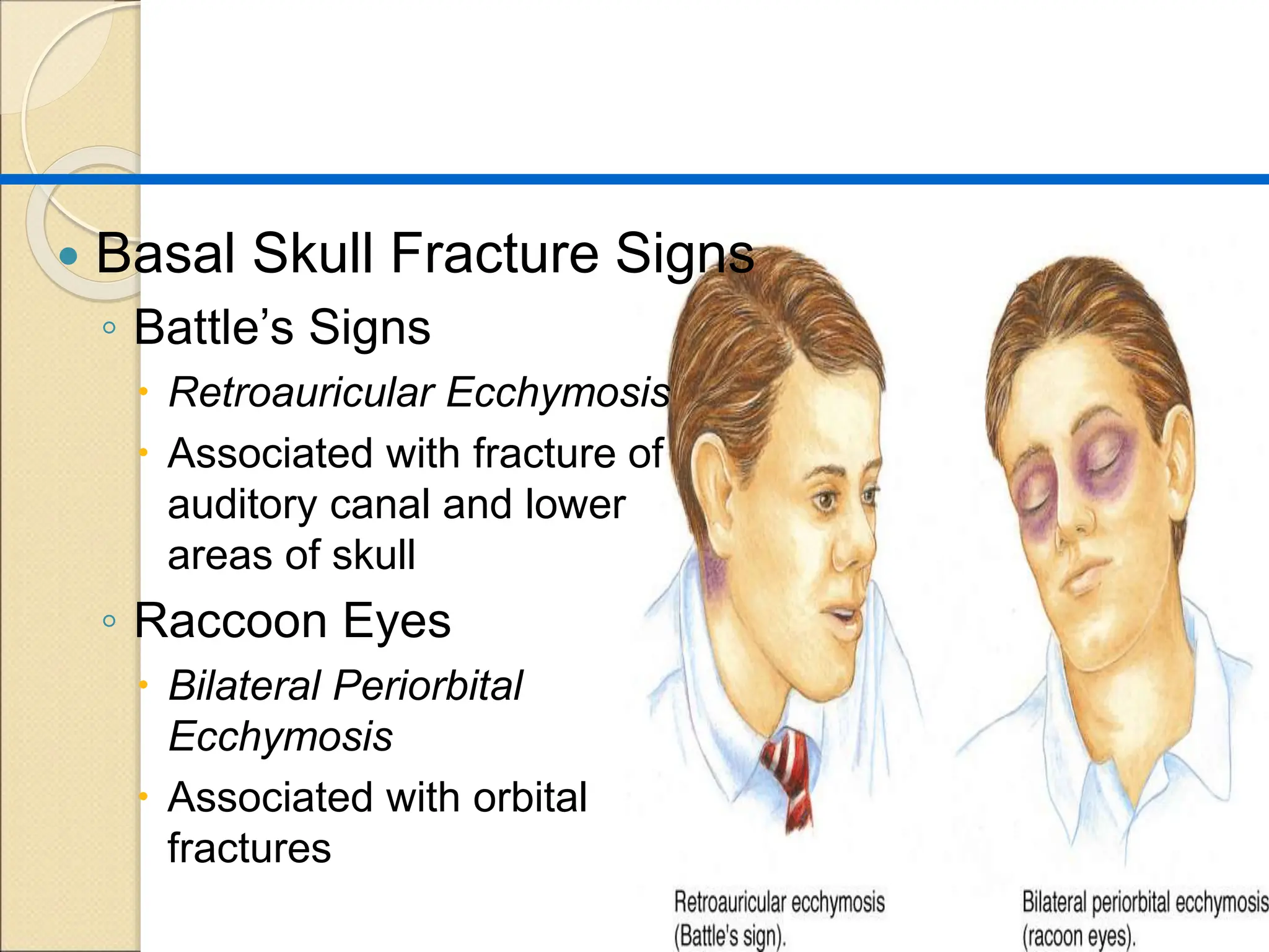 head-injury head injury HEAD INJURY .ppt