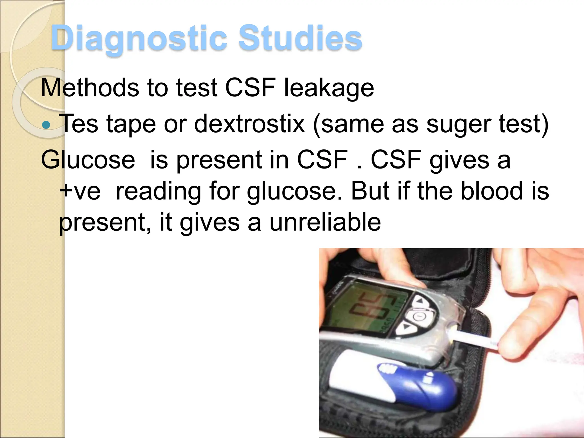 head-injury head injury HEAD INJURY .ppt