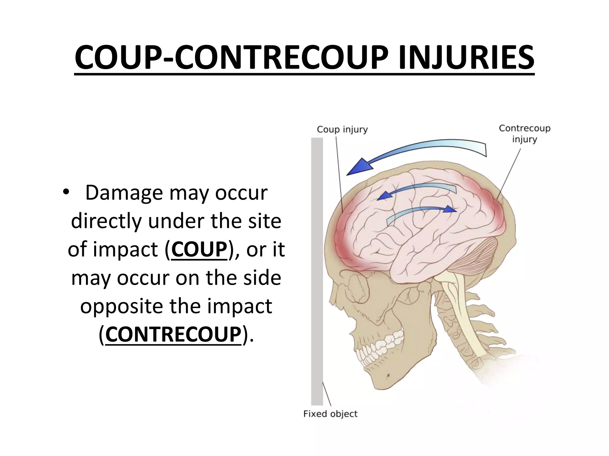 Head injuries | PPTX