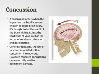 Head-Injury 2024 bt assisst prof.dr.amer-ppt.pptx