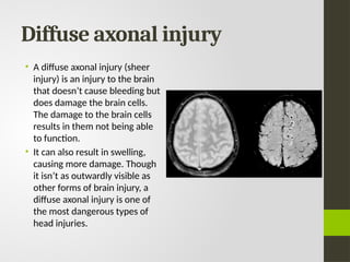 Head-Injury 2024 bt assisst prof.dr.amer-ppt.pptx