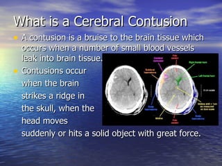 Head Injury | PPT