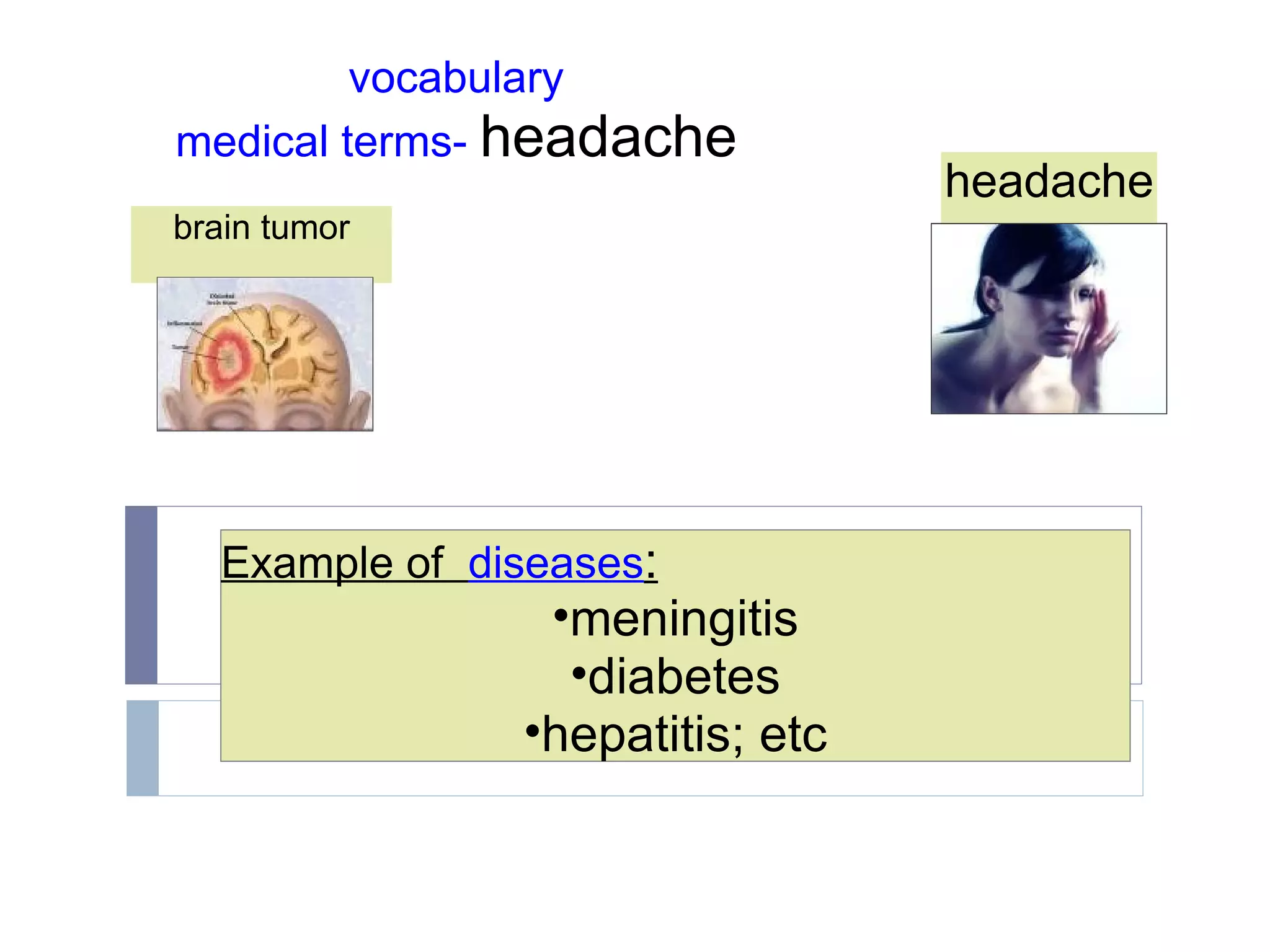 Headache | PPT