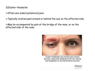 Headache | PPTX