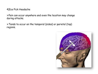 Headache | PPT