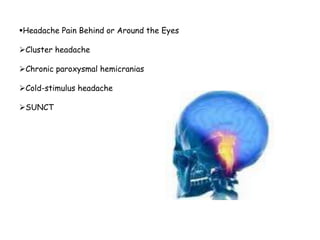 Headache | PPT