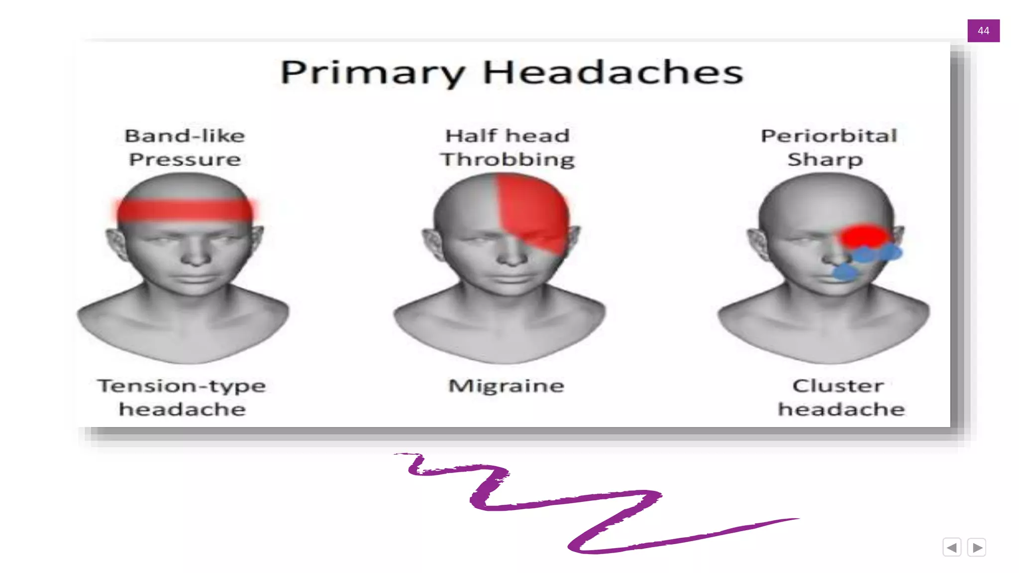 Headache types & management | PPTX