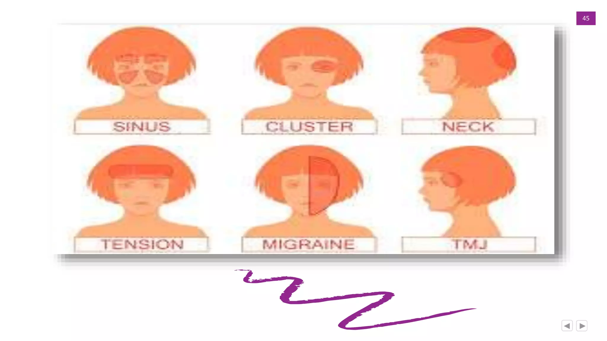 Headache types & management | PPTX