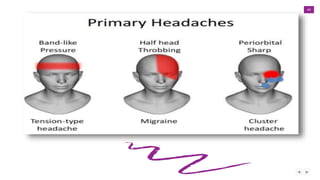 Headache types & management | PPTX