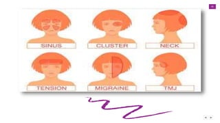 Headache types & management | PPTX