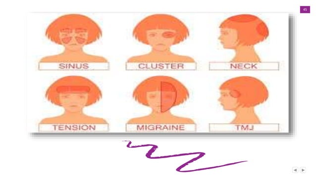 Headache types & management | PPTX