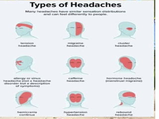 Approach to headache clinical presentation and management | PPTX