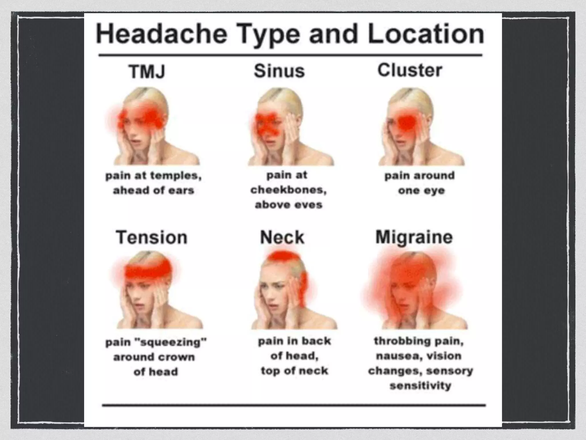 Headache (tension type headache, migraine) | PPTX