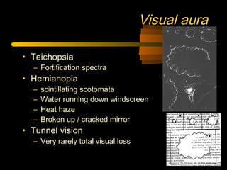 Headaches presentation at www.eyenirvaan.com