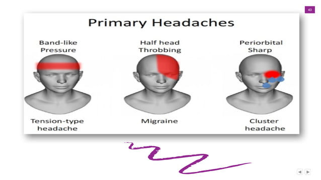 HEADACHE SYNDROME in patients with various ages | PPT