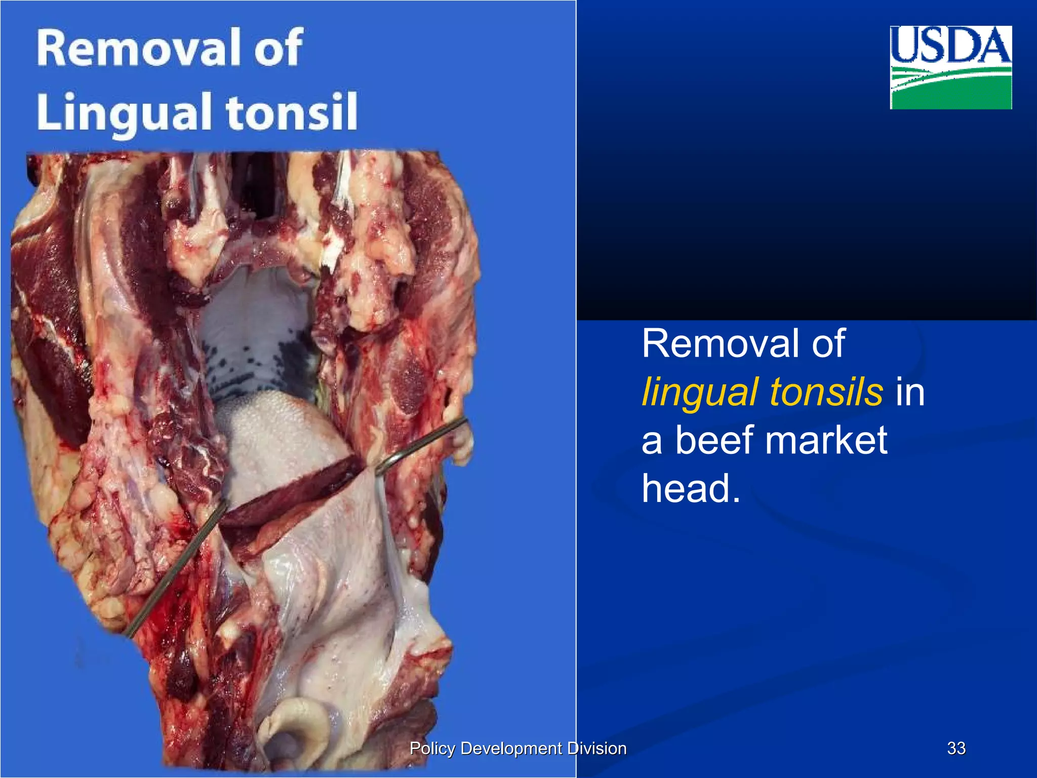 Head anatomy& lymph nodes | PPT
