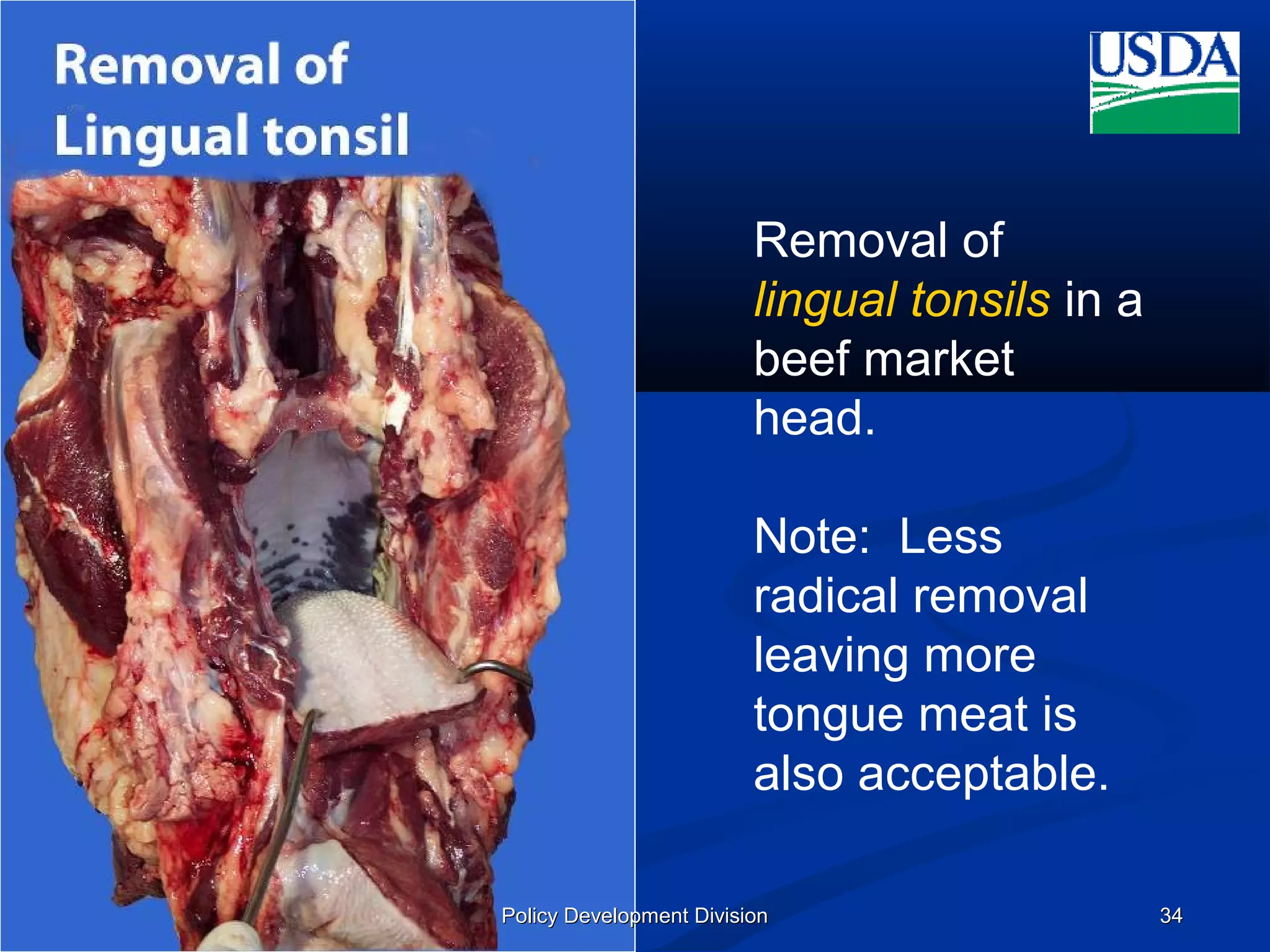 Head anatomy& lymph nodes | PPT
