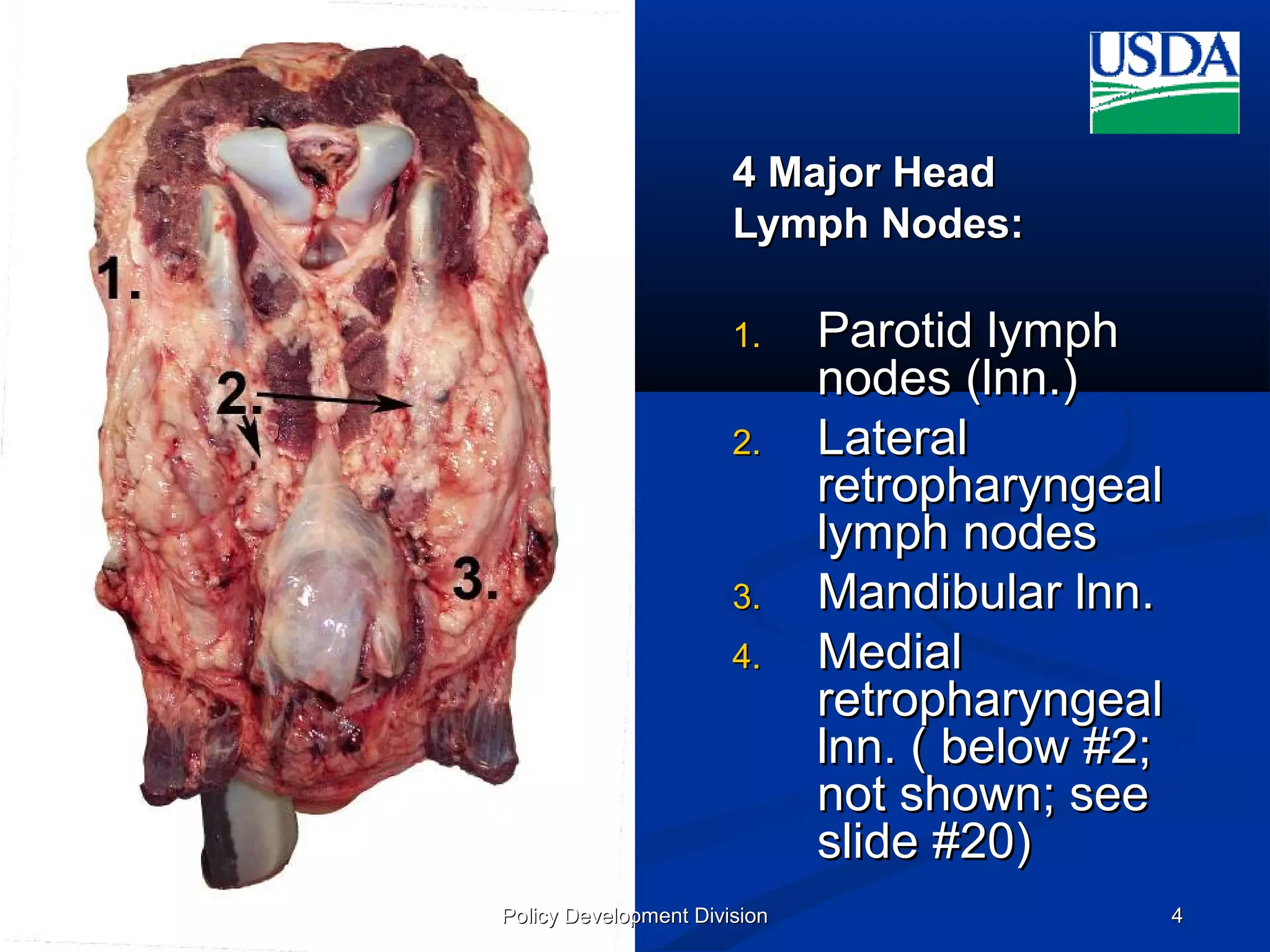 Head anatomy& lymph nodes | PPT