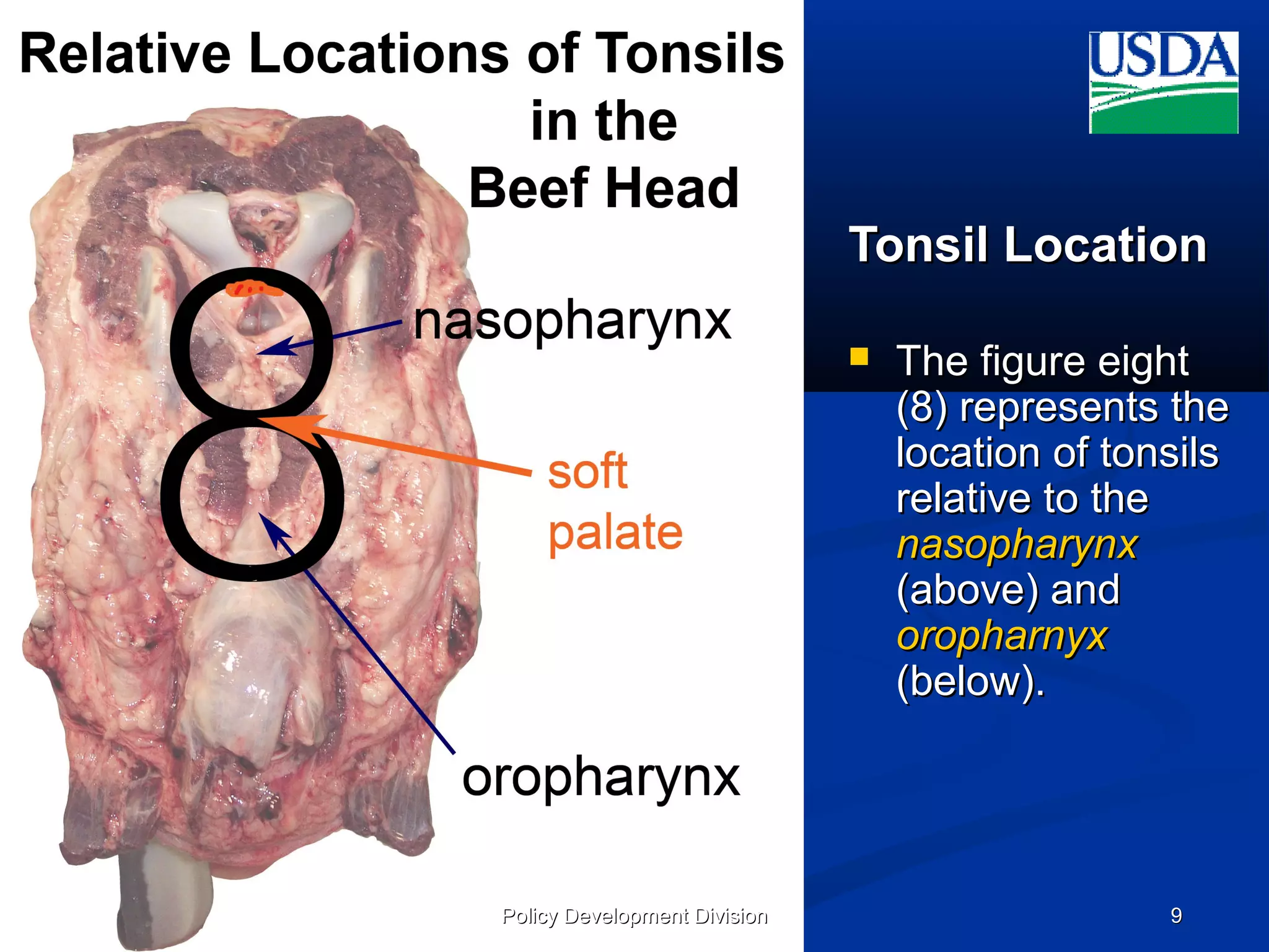 Head anatomy& lymph nodes | PPT