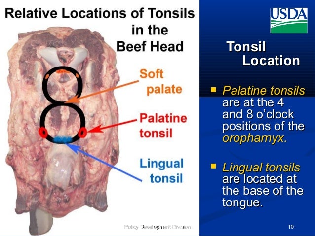 Head anatomy& lymph nodes