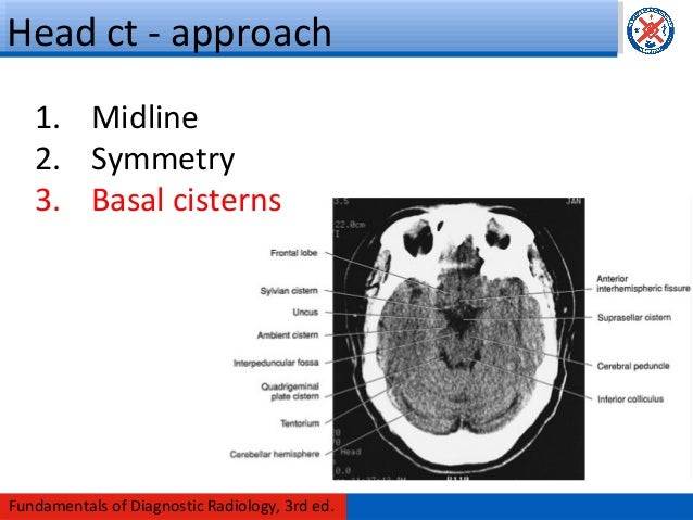 Head and cervical spine imaging